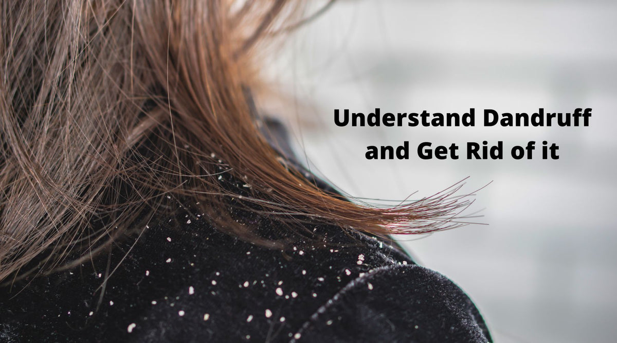 Understand Dandruff and Get Rid of it – HERBCIENCE